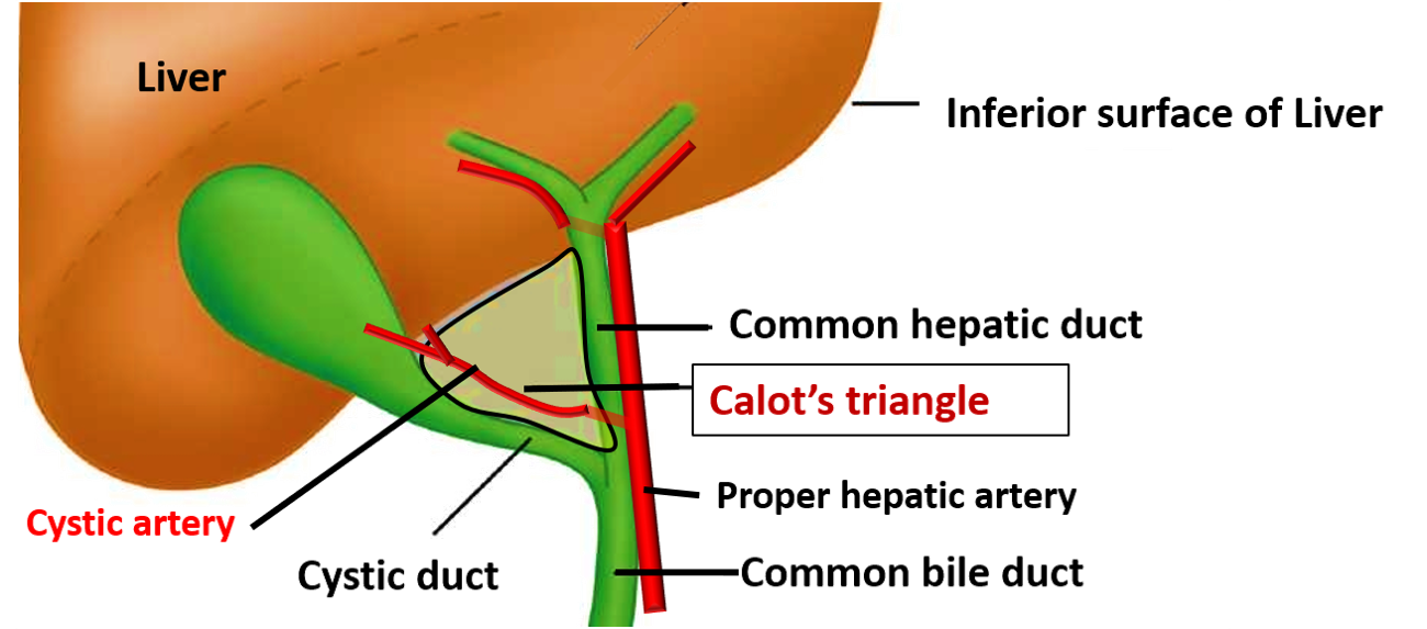 Calots Triangle