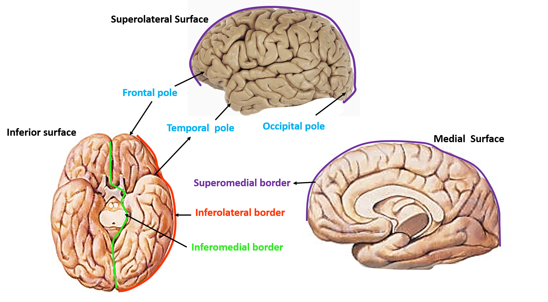 Cerebrum Exam Questions Anatomy QA Cerebrum Exam Questions Anatomy QA
