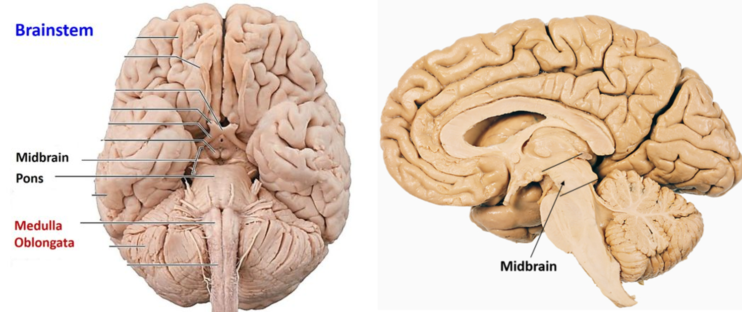 Midbrain Anatomy External And Internal Features Arterial Supply And Midbrain Anatomy External And Internal Features Arterial Supply And