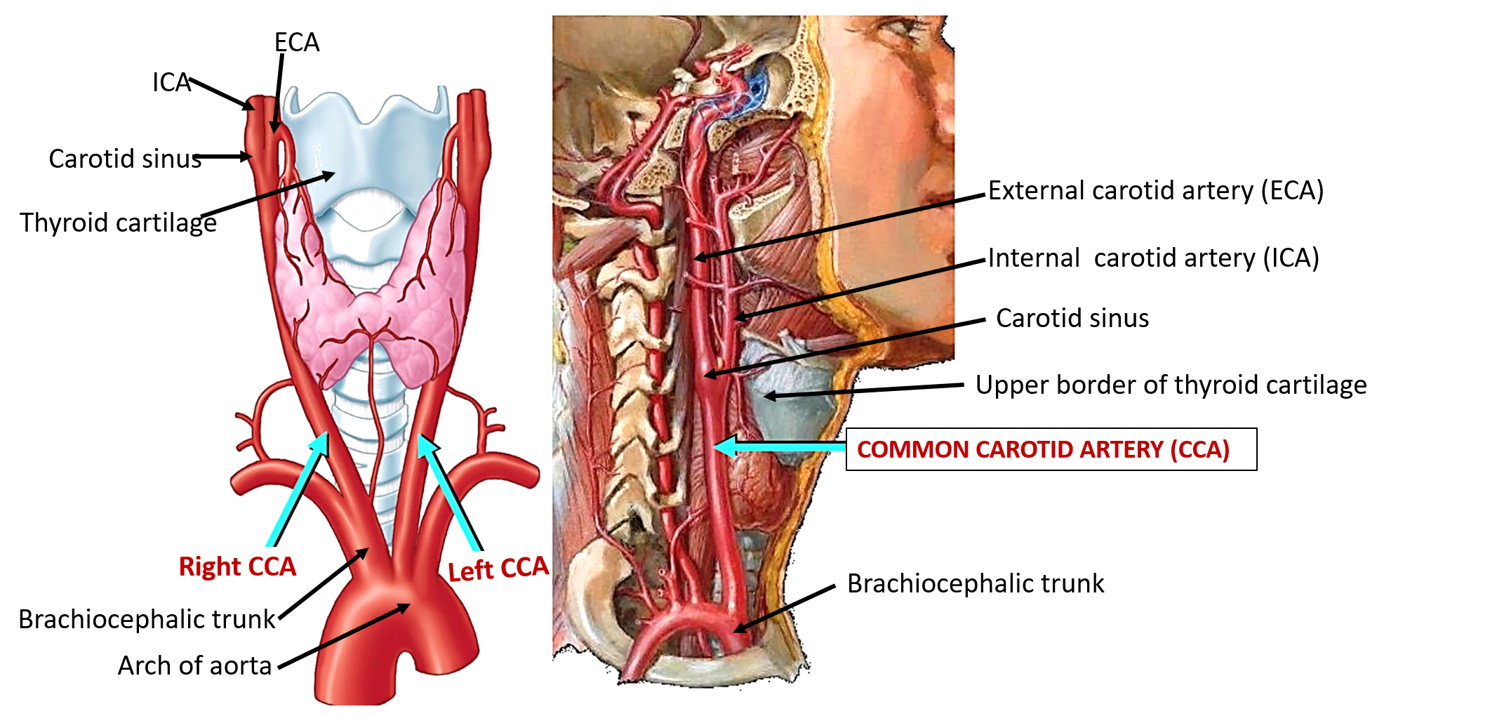 Common Carotid Artery Carotid Sinus And Carotid Body Anatomy QA