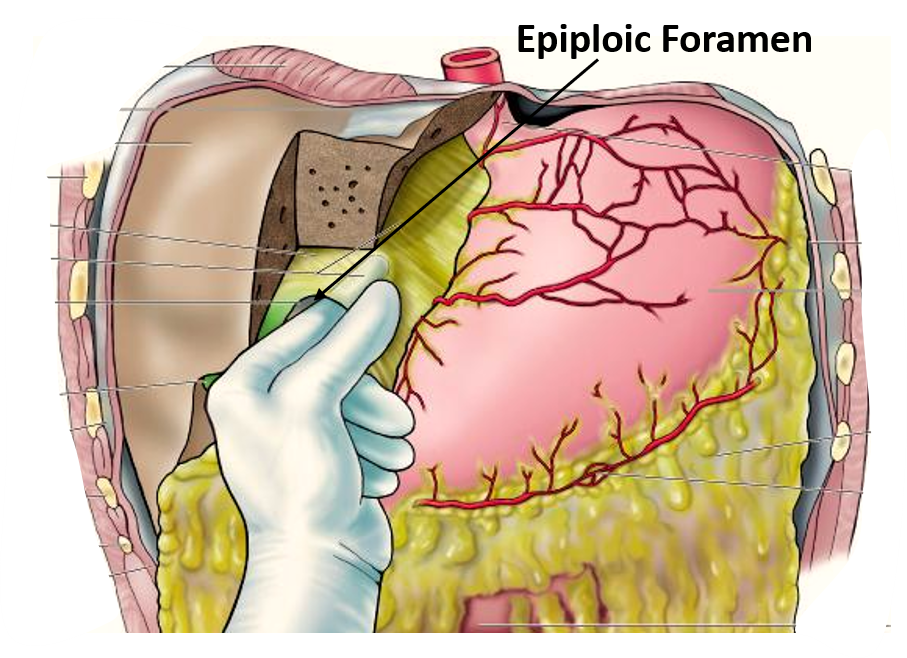 Lesser Sac And Epiploic Foramen Bouundaries And Applied Aspects