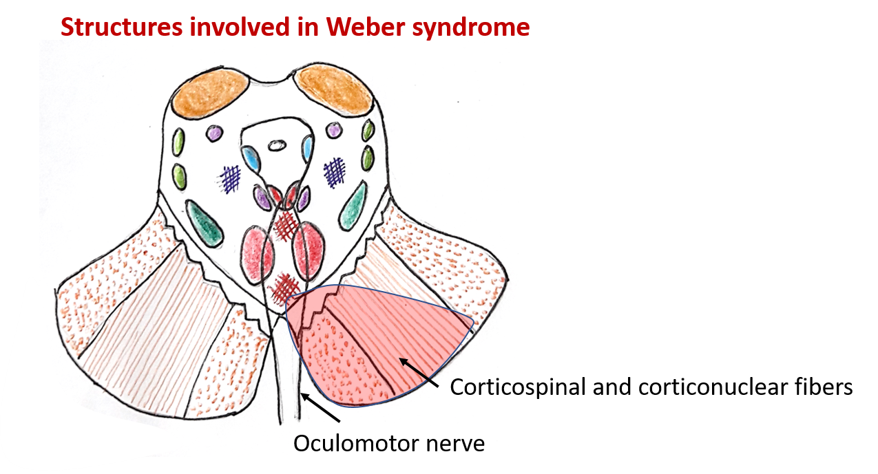 Midbrain Anatomy – Anatomy QA