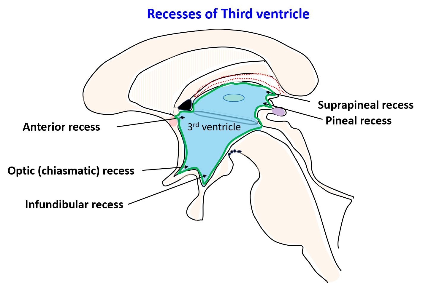 Third Ventricle Anatomy Qa