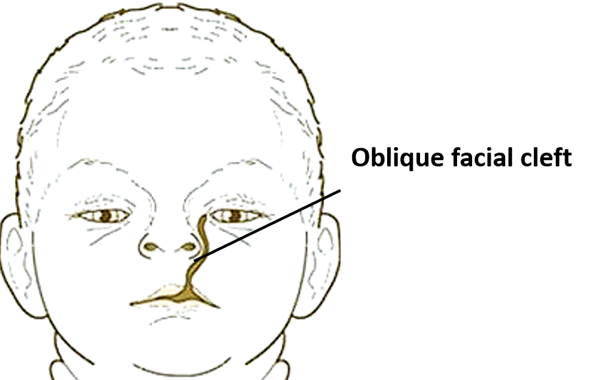Development Of Face Anatomy Qa